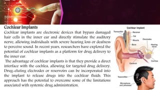 otic delivery system.pdf