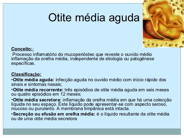 Otite media aguda