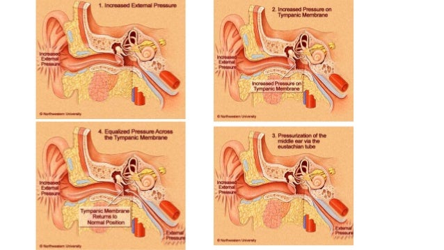 Otitic barotrauma by Dr Manohar Suryawanshi ENT resident INHS Asvini,…