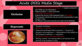 Acute Otitis Media | PDF
