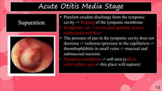 Acute Otitis Media | PDF