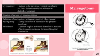 Acute Otitis Media | PDF