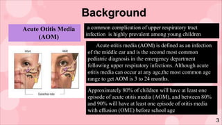 Acute Otitis Media | PDF