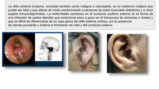 EXPO - OTITIS EXTERNA, MEDIA e INTERNA (CLINICAS) | PPTX
