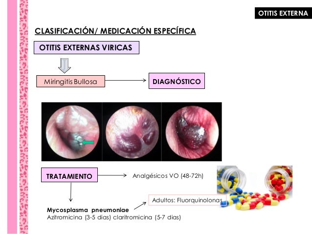 Otitis externa