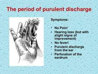 Otitis externa and media | PPT