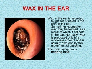 Otitis externa and media | PPT