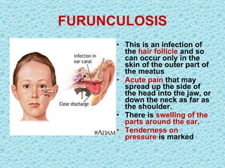 Otitis Externa Vs Normal Ear