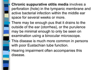 otitis-media.ppt