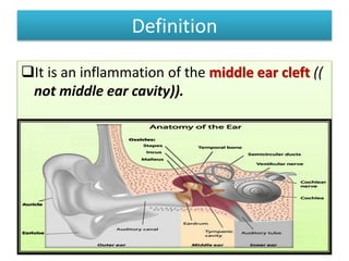 Otitis media ENT | PPTX