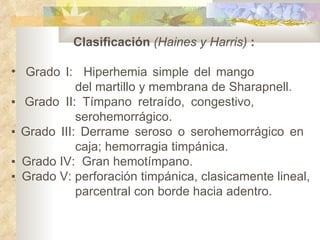 Otitis barotraumatica | PPT
