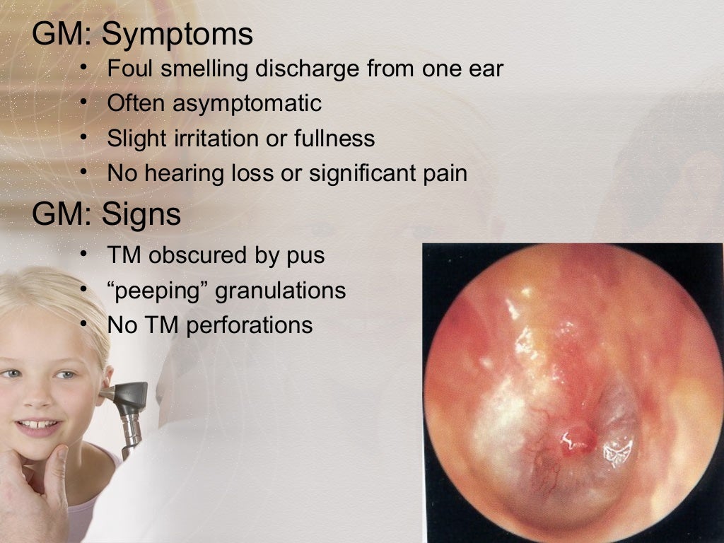 Otitis externa