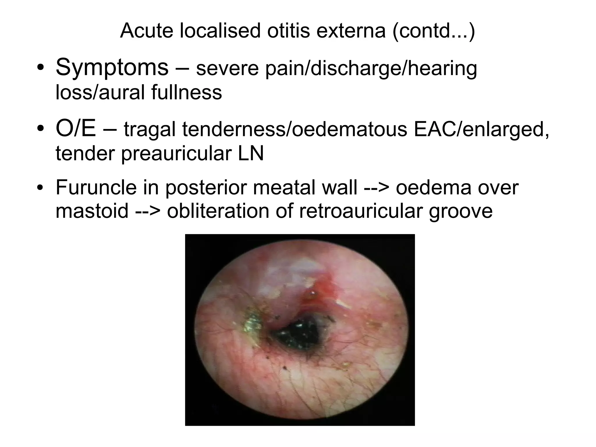 Otitisexterna BY DR MUHAMMAD USMAN GHANI (KSMC ) | ODP