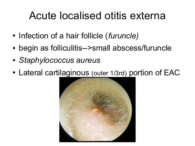 Otitis Externa Furuncle
