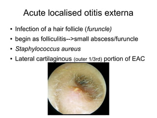 Diffuse Otitis Externa