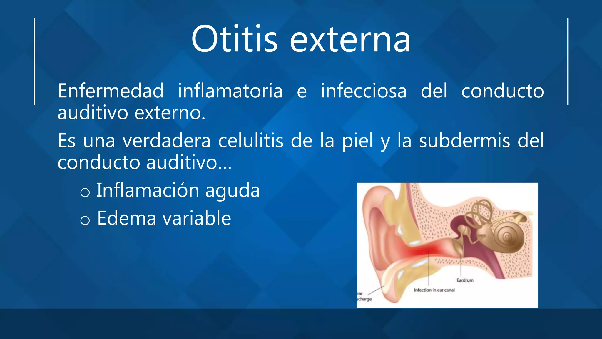 Otitis externa | PPT