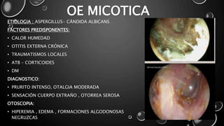 OTITIS EXTERNA- presentacion de la clinicas- | PPTX