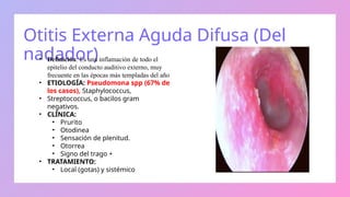 ORL -Presentacion de Otitis Externa.pptx
