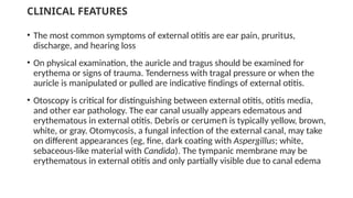 Otitis Externa.pptx1234556666777543334677 | PPTX