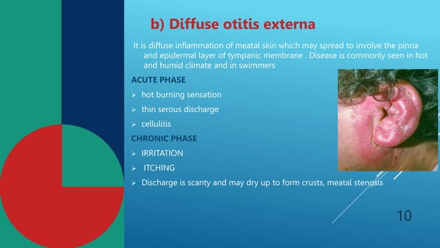 OTITIS EXTERNA | PPTX | Ear, Nose and Throat Conditions | Diseases and ...