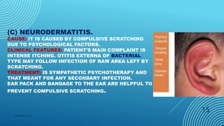 OTITIS EXTERNA | PPTX