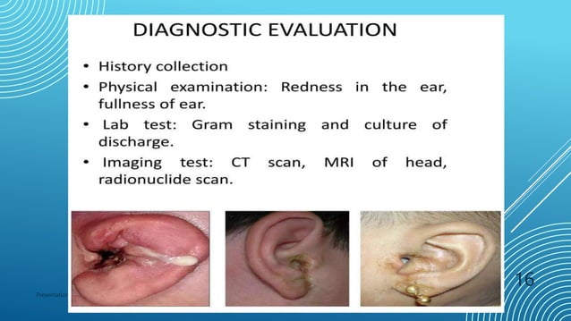 OTITIS EXTERNA | PPTX | Ear, Nose and Throat Conditions | Diseases and ...