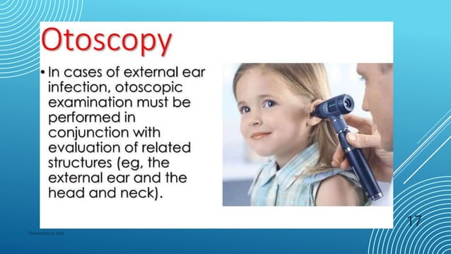 OTITIS EXTERNA | PPTX | Ear, Nose and Throat Conditions | Diseases and Conditions