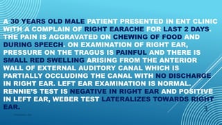 OTITIS EXTERNA | PPTX