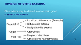 OTITIS EXTERNA | PPTX