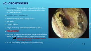 OTITIS EXTERNA | PPT