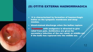 OTITIS EXTERNA | PPT