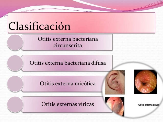 ¿Cuál Es El Cuadro Clínico De La Otitis Externa Difusa – AZZU