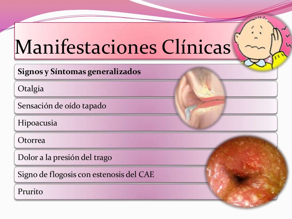 Otitis Externa Wikipedia : Akute Otitis Externa – BKZXTZ