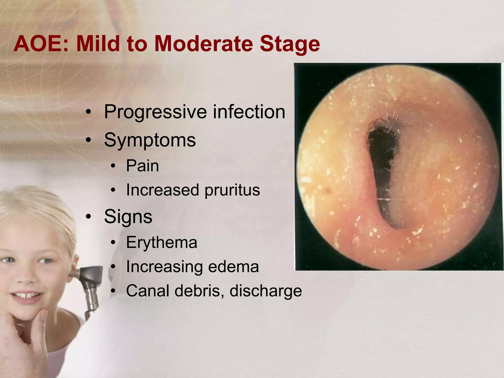 Otitis externa | PPT | Free download