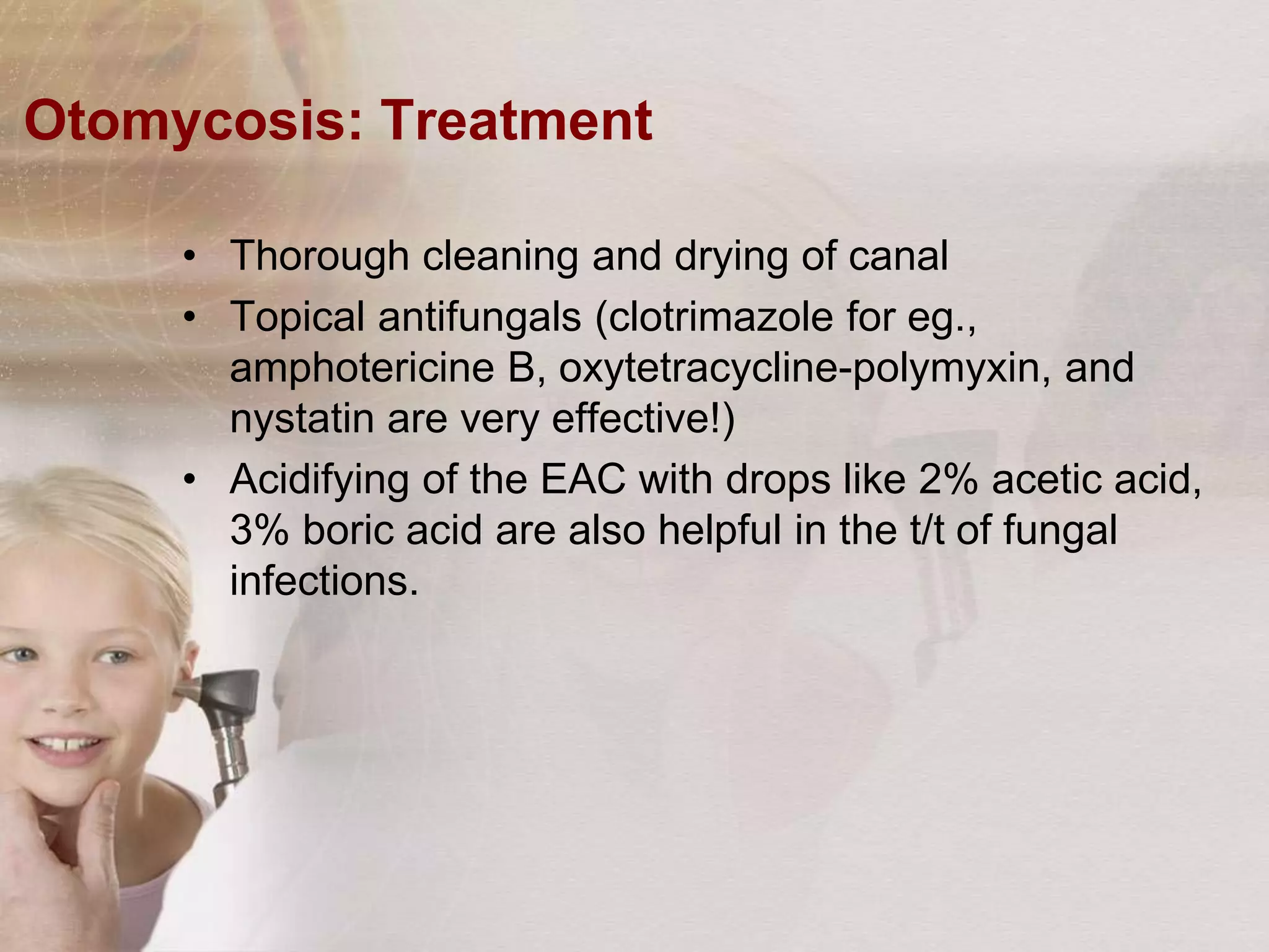 Otitis externa | PPTX