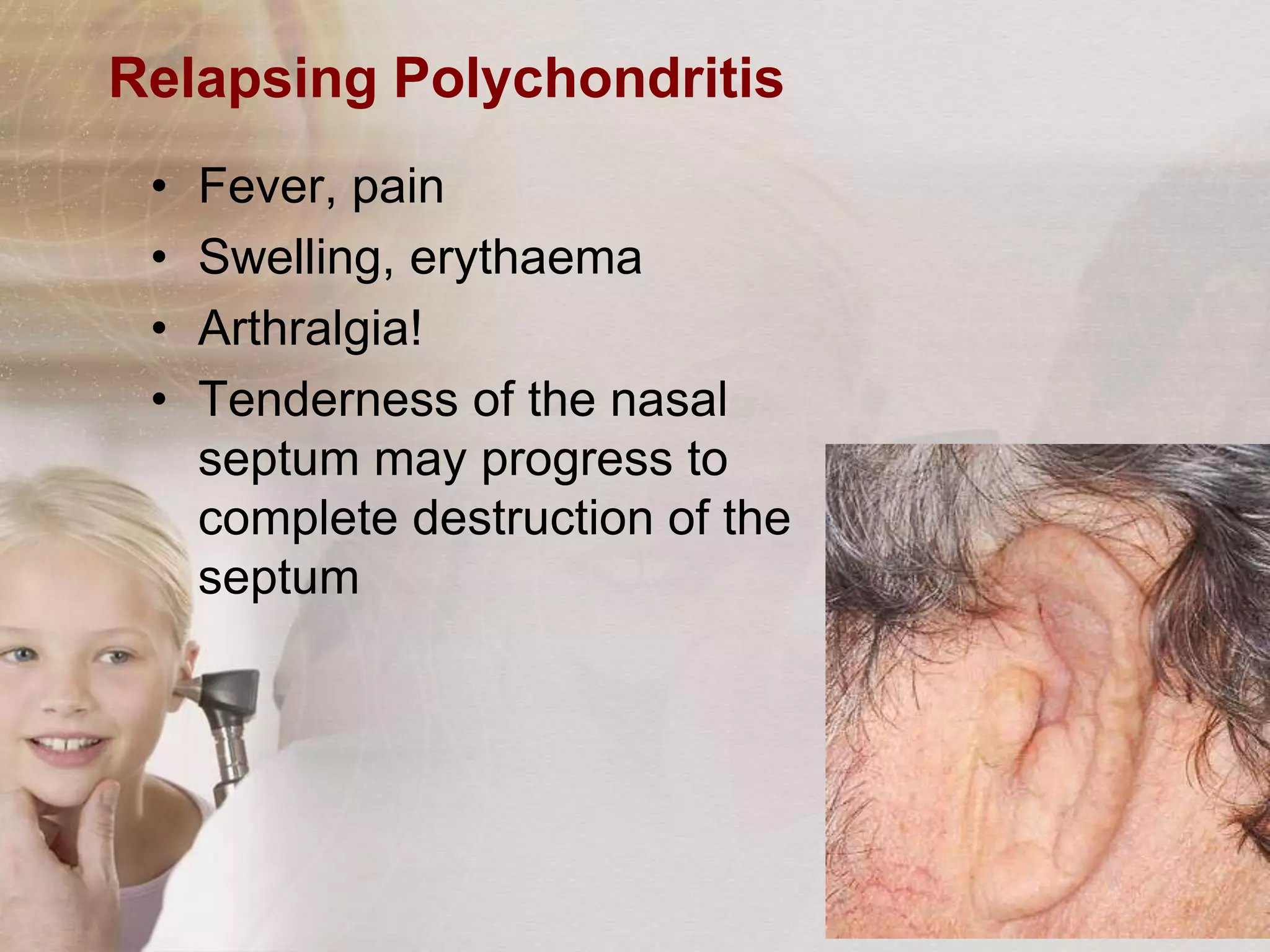 Otitis externa | PPTX