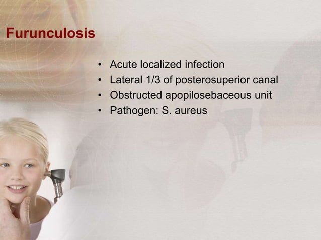 Otitis externa | PPT