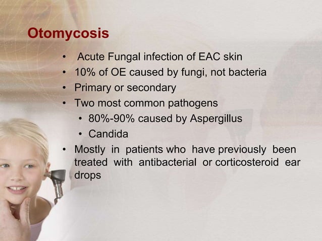 Otitis externa | PPTX
