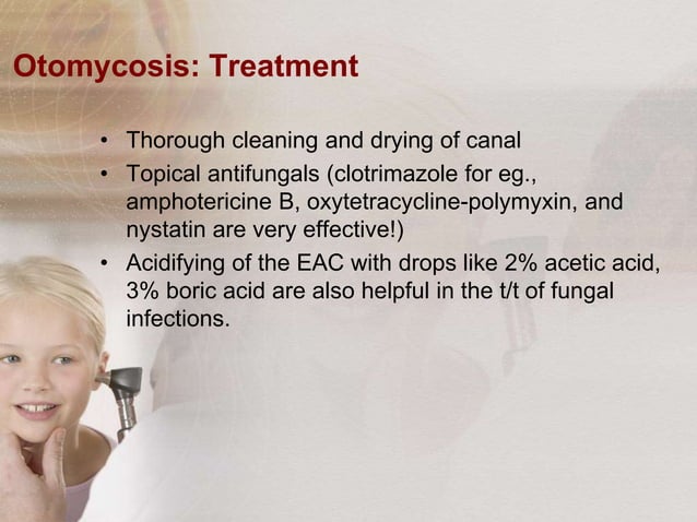 Otitis externa | PPTX
