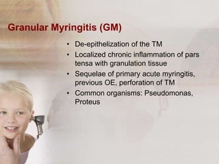 Otitis externa | PPTX