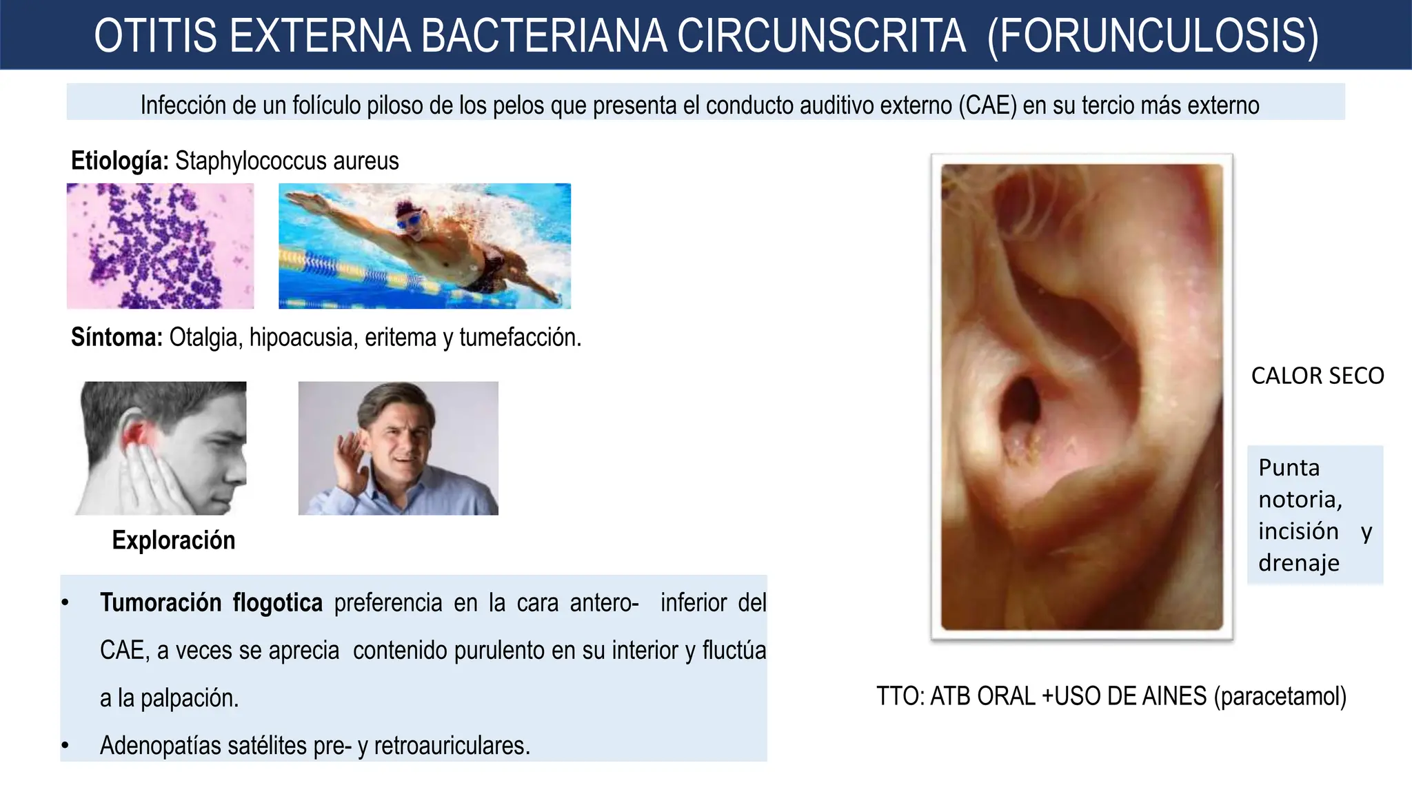 OTITIS EXTERNA AGUDA.pptx