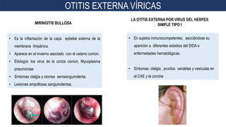 OTITIS EXTERNA AGUDA.pptx