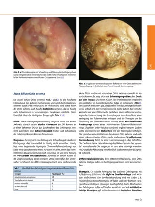 otitis externa ARTICULO.pdf