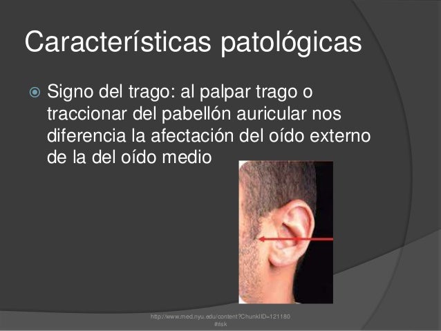 Otitis externa (Oído de nadador)