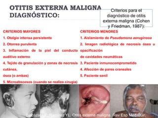 Otitis Externa Maligna Pseudomonas