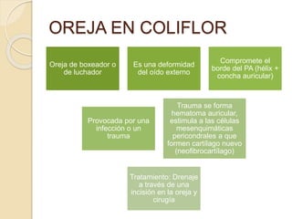 Otitis externa y media | PPTX