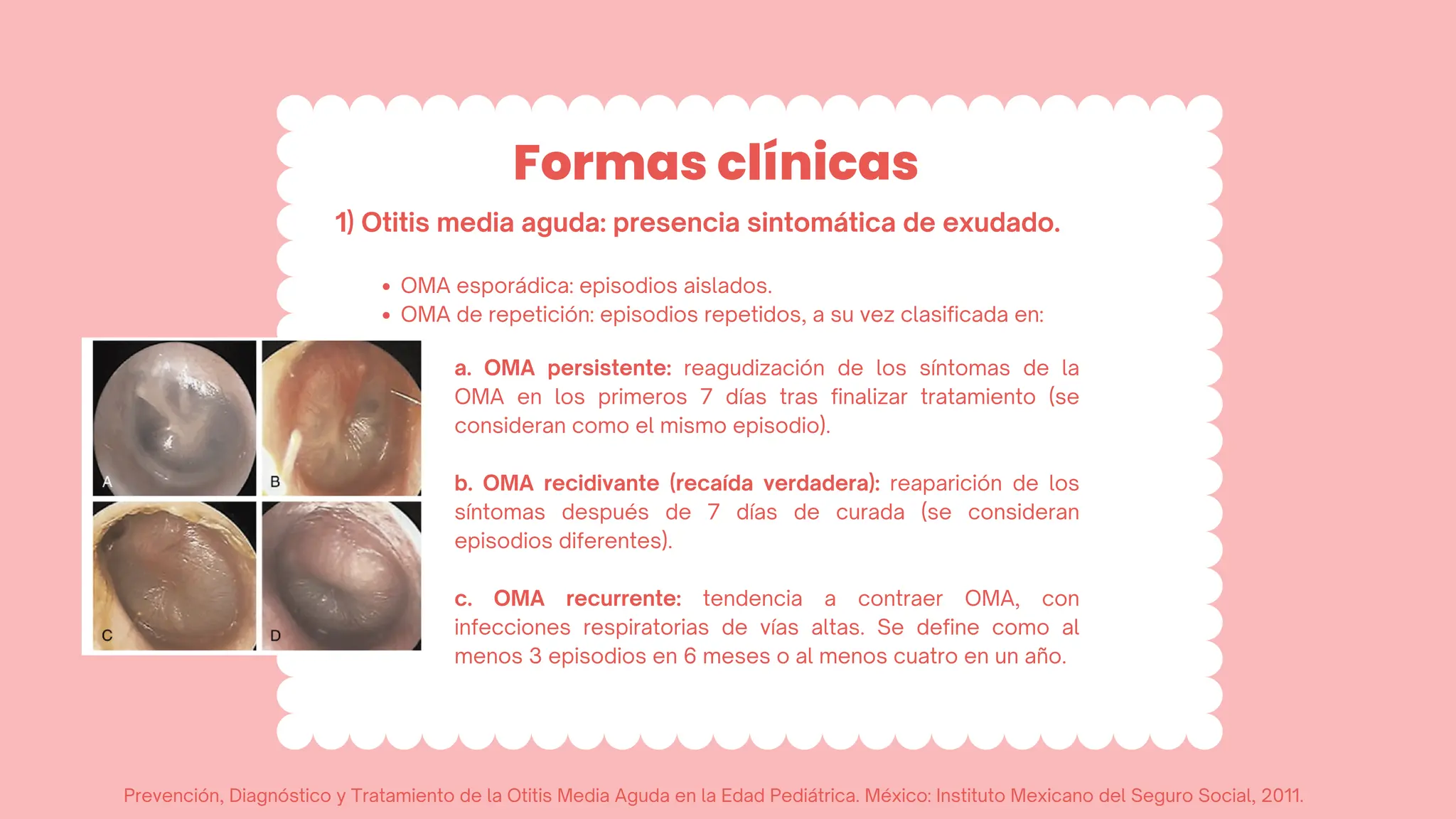 Otitis externa y otitis media del paciente pediatrico | PDF