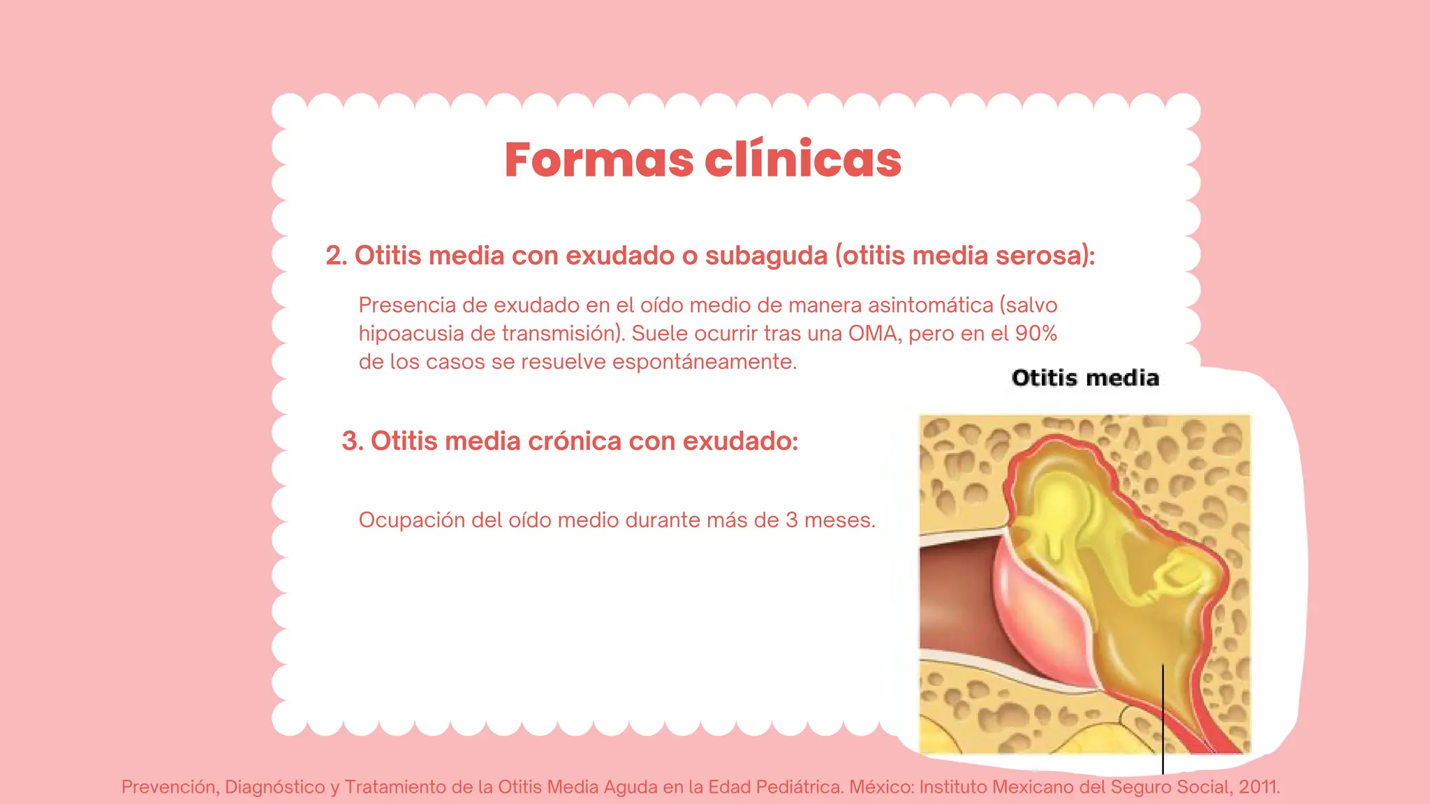 Otitis externa y otitis media del paciente pediatrico | PDF
