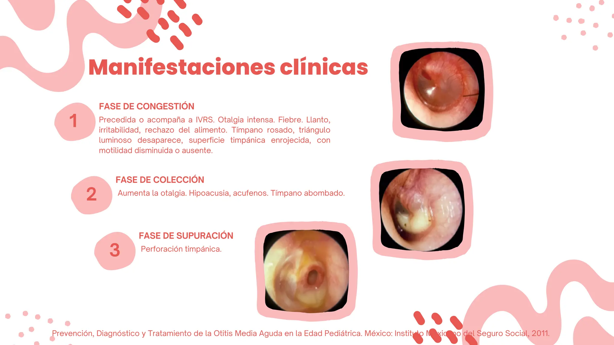 Otitis externa y otitis media del paciente pediatrico | PDF