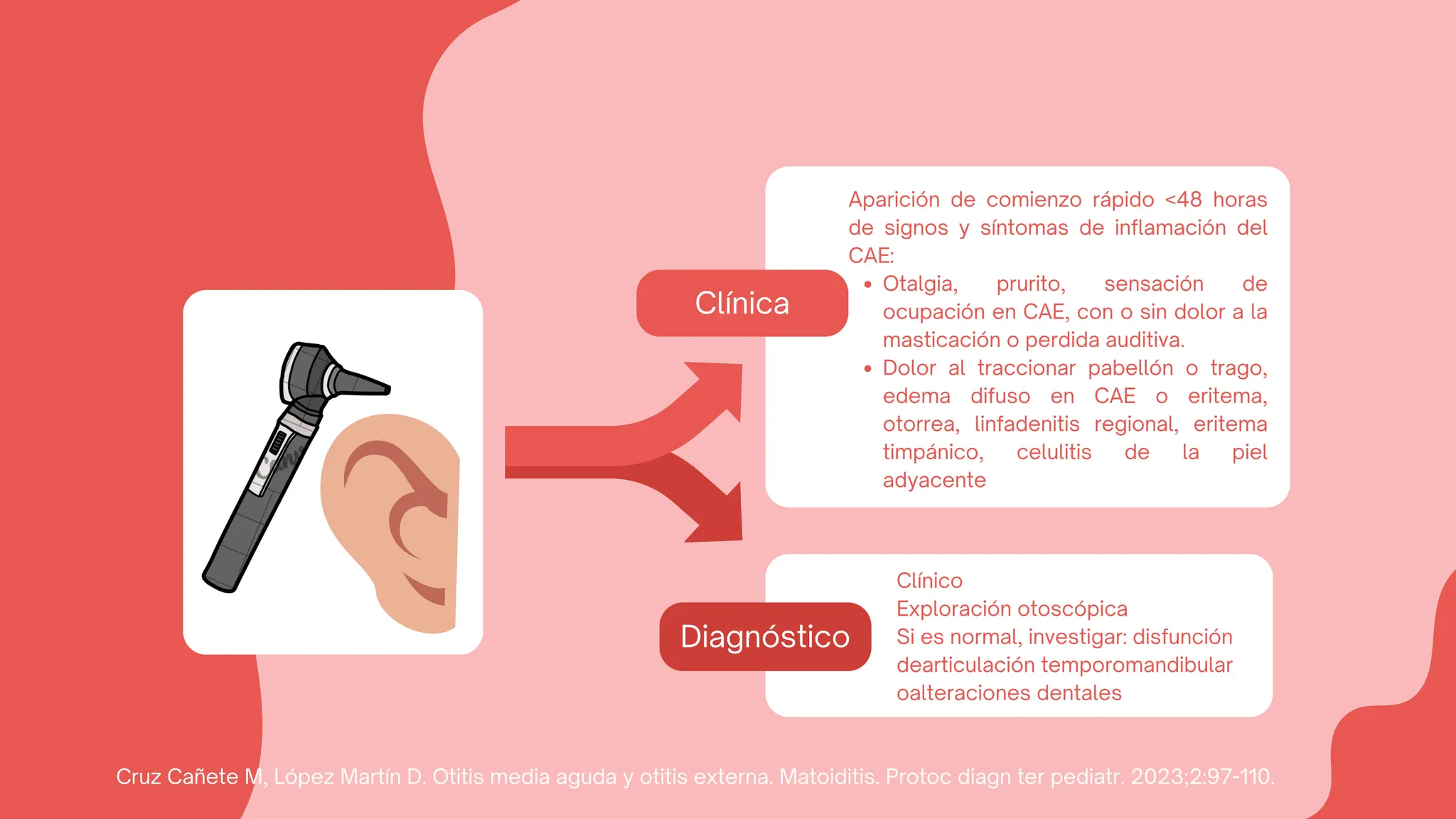 Otitis externa y otitis media del paciente pediatrico | PDF